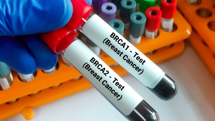 New Guidelines Expand BRCA Testing and Screening for Men - - AXISMedEd