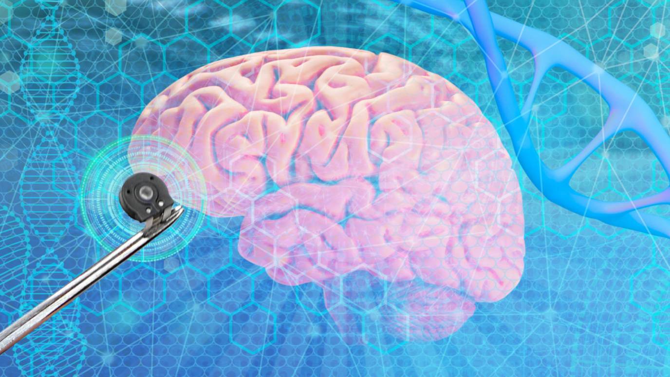 How Brain-Computer Interface Treatment for Strokes Is Helping Patients ...