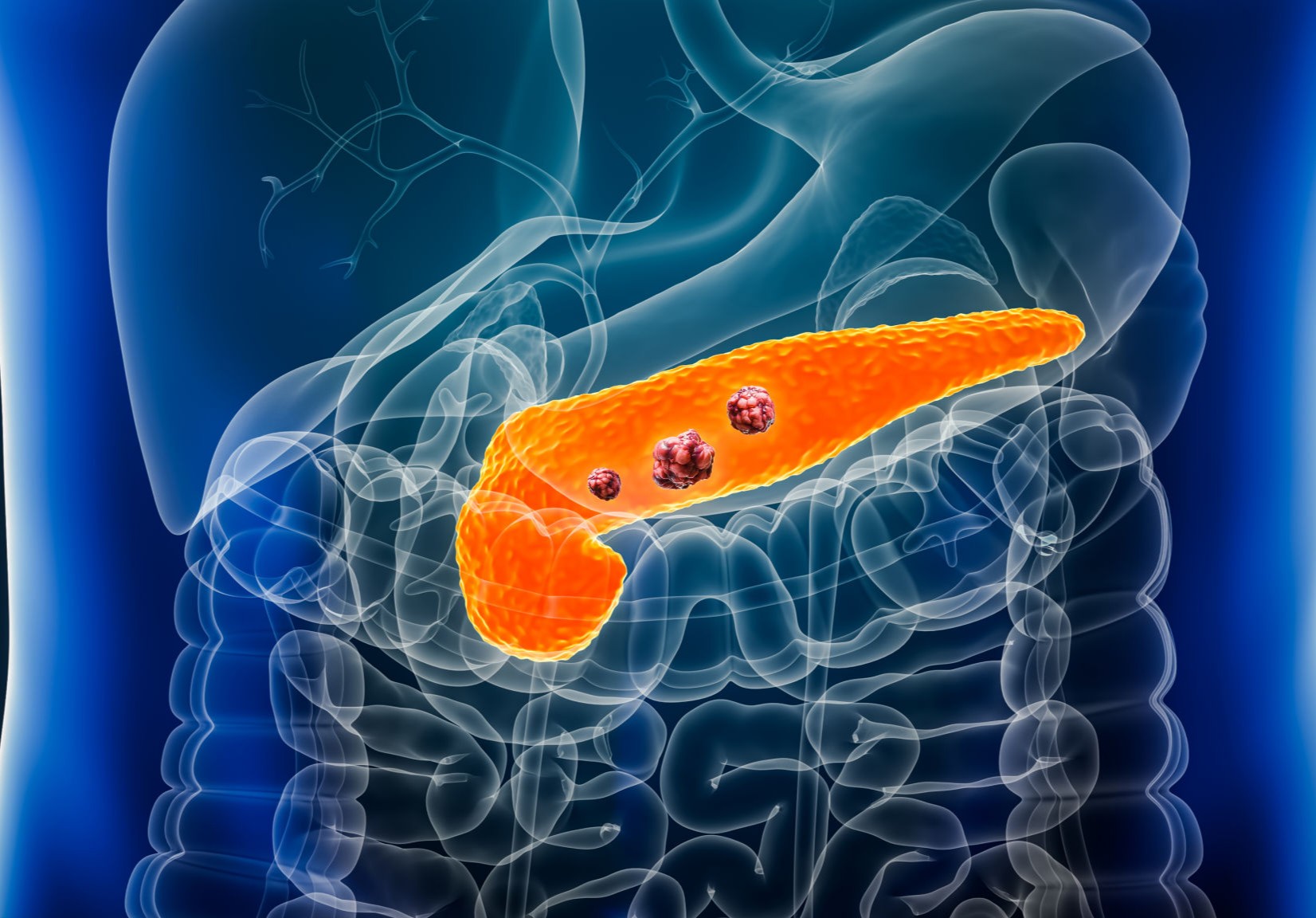 Scientists Use Organoid Model to Identify Potential New Pancreatic ... Scientists Use Organoid Model to Identify Potential New Pancreatic ...