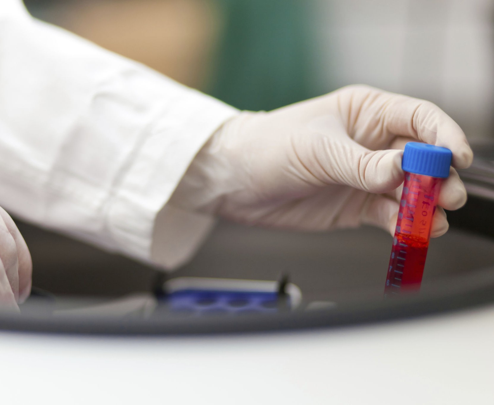 FDA Approves New First-Line Treatment Option for Metastatic Pancreatic ...