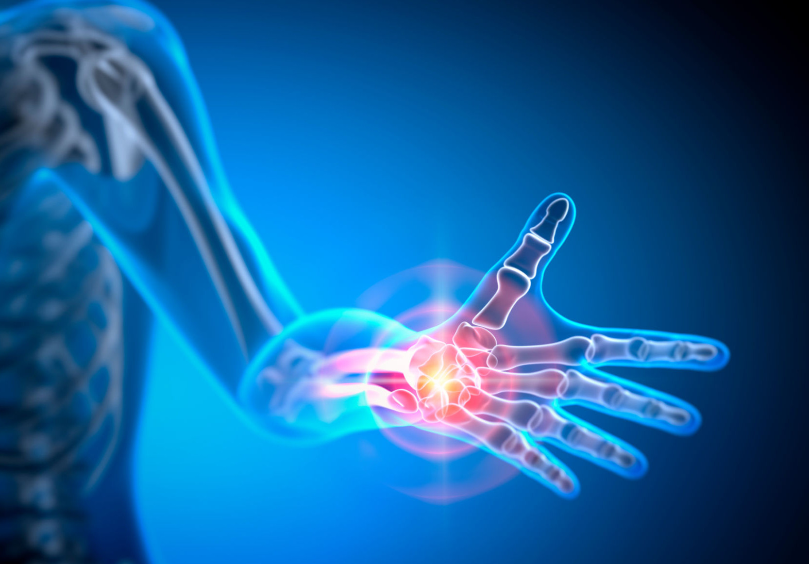 Video-Assisted Hand Therapy Is Effective After Thumb Arthritis Surgery ...