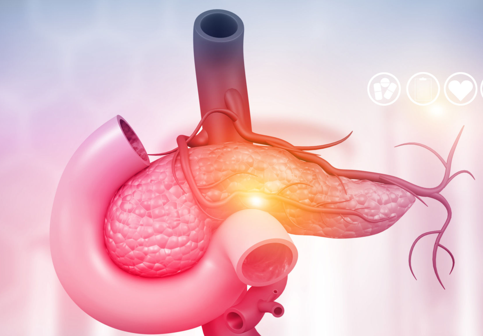 Candel Wins FDA Orphan Drug Designation for Pancreatic Cancer Drug ...