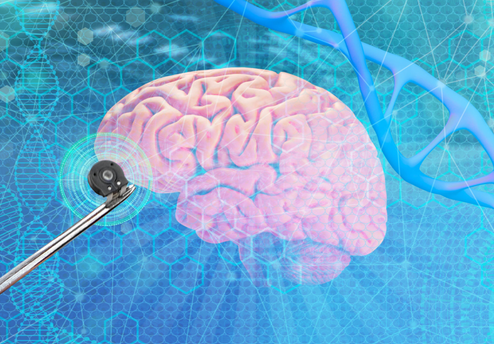 How Brain-Computer Interface Treatment for Strokes Is Helping Patients ...